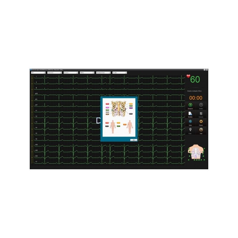 ECG PC SE-1515 DE 15 Edan | Teamalex Medical