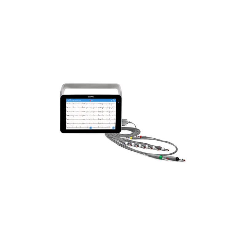 Electrocardiographe ECG 12 dérivations portable | Teamalex Medical