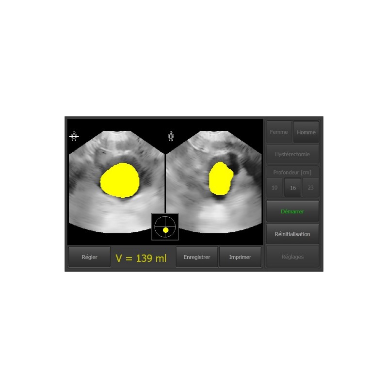 Bladder Scanner Vitascan LT – 0-1000 mL volume modernisé | Teamalex