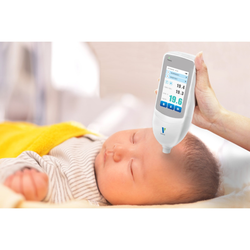 Bilirubinomètre David BM-100A | Biliflash | Teamalex Medical