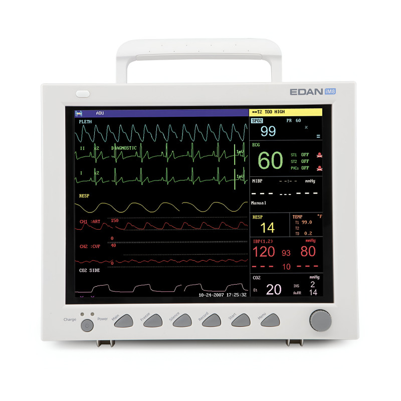 Moniteur de surveillance iM8 EDAN | Teamalex Medical Technologies
