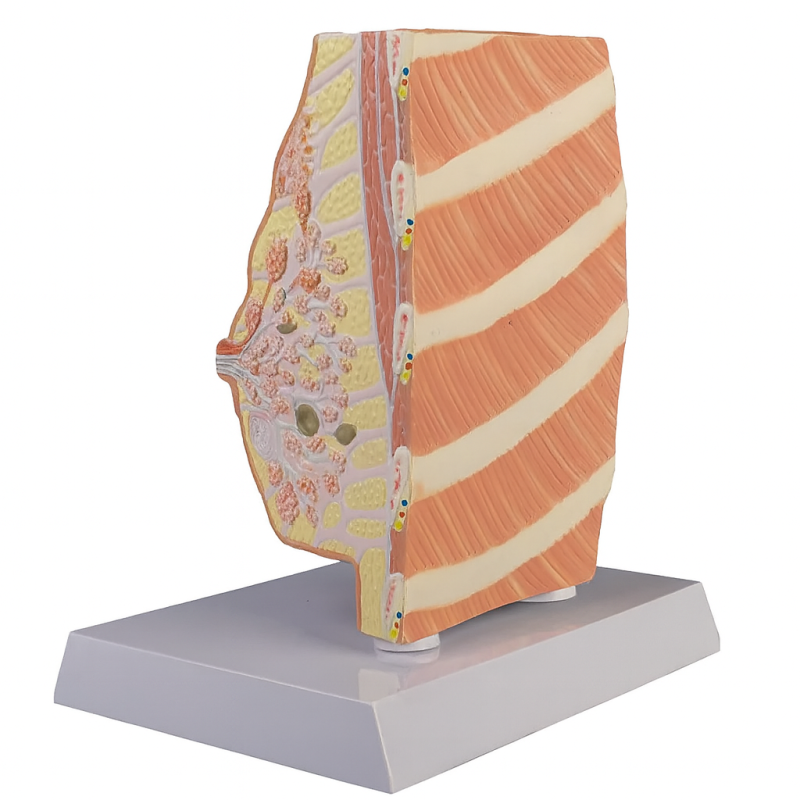 Coupe du sein avec maladies, Modèle anatomique L280 | Teamalex Medical